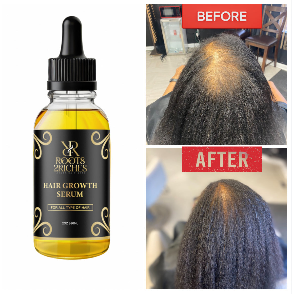 Ultimate Guide to Using Hair Growth Oil for Maximum Results – Roots2Riches